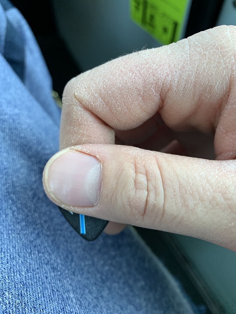 Pick grip conundrum - Playing Technique - The Cracking the Code Forum